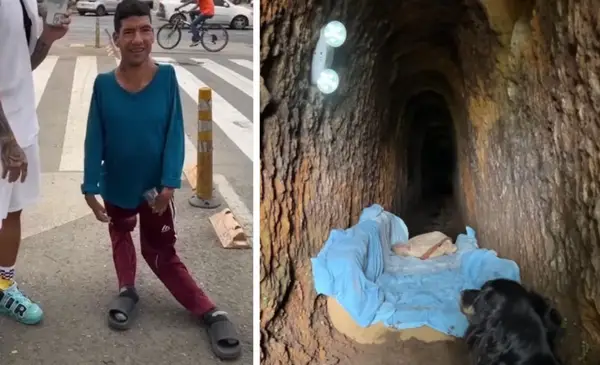 [VIDEO] Conozca la triste historia de Jerson el hombre canguro que nació en Colombia | Red Uno ...